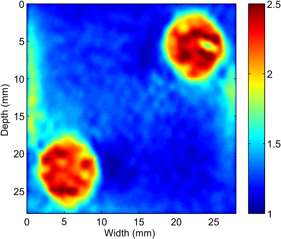 Modeling needle-tissue interactions - Surgical Robotics Lab