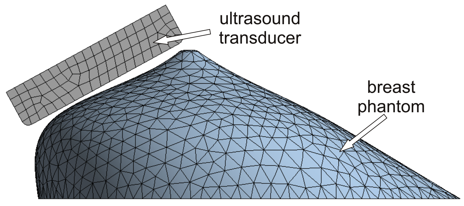 Predicting Target Displacements Using Ultrasound Elastography And