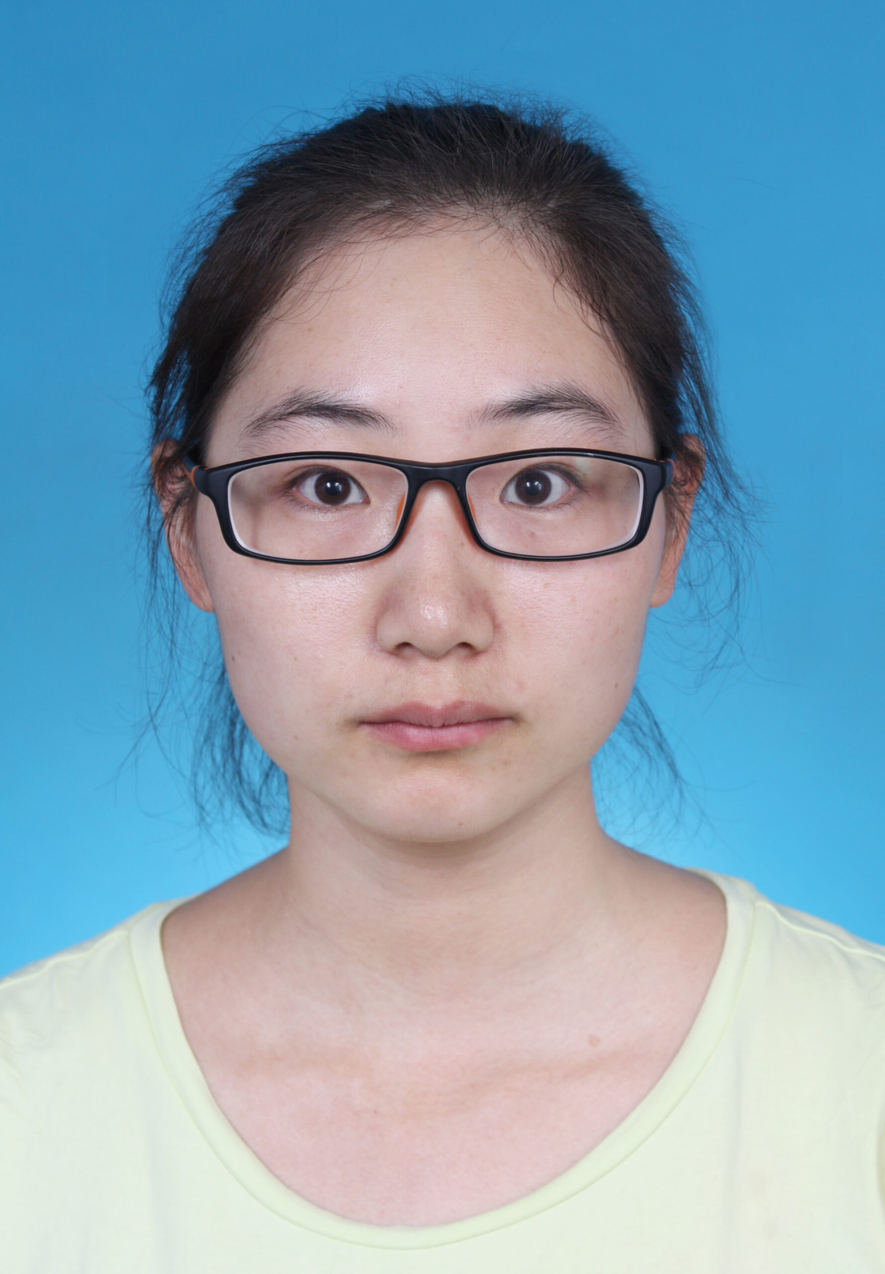 Yiyang Li - Surgical Robotics Lab