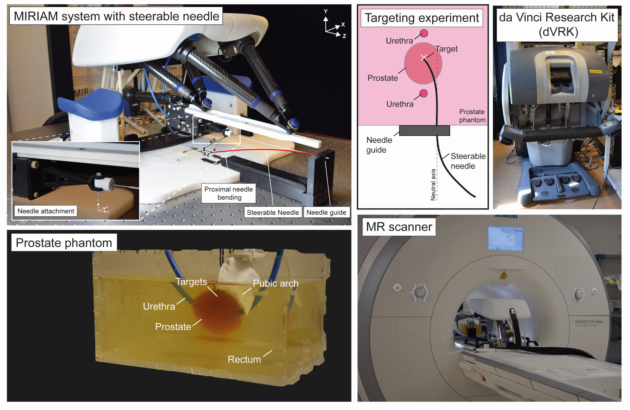MR-guided HDR prostate brachytherapy with teleoperated steerable ...