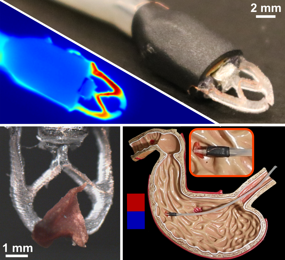 Miniaturized Variable Stiffness Gripper Locally Actuated By Magnetic Fields Surgical Robotics Lab